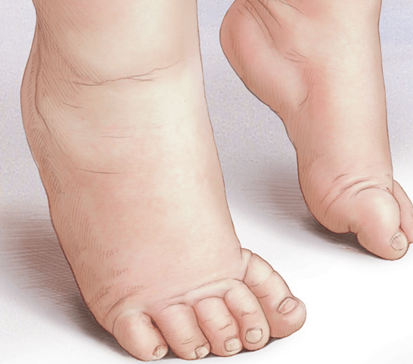 Paediatrics – Children to Young Adult